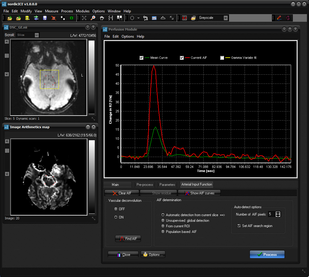 Perfusion analysis settings